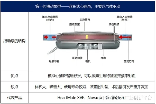 心脏机械辅助装置（PVAD）ECMO人工心脏厂家-CSDN博客