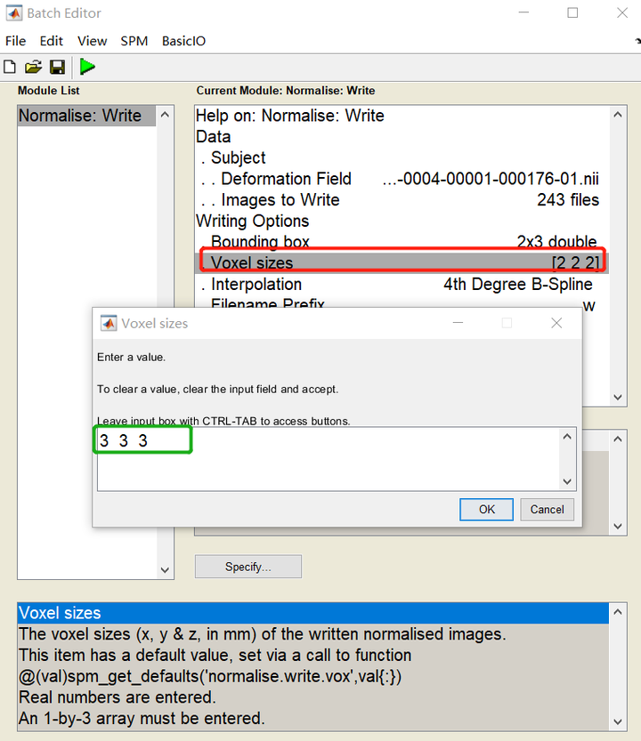 SPM数据预处理【“傻瓜”操作版】-CSDN博客