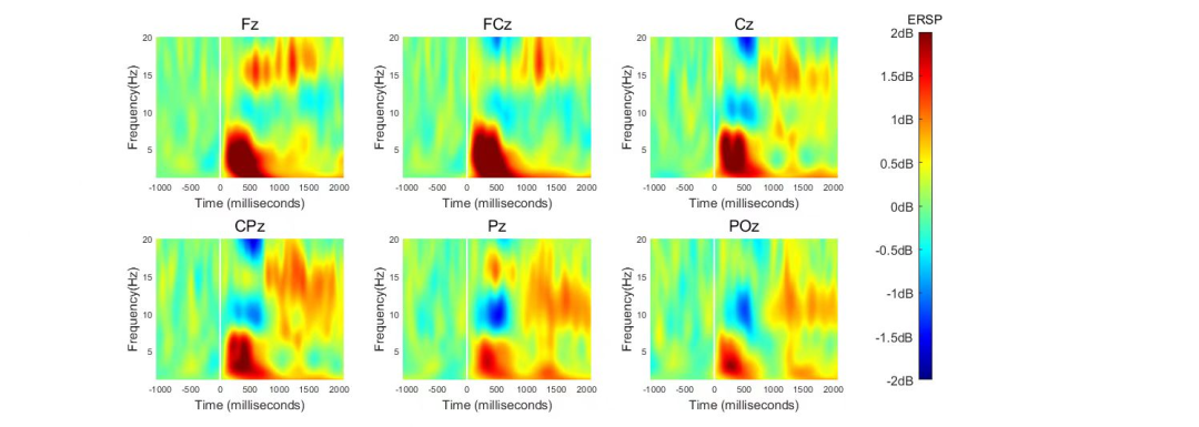 北理工团队创建自然场景下声音目标探测的听觉脑机接口-CSDN博客