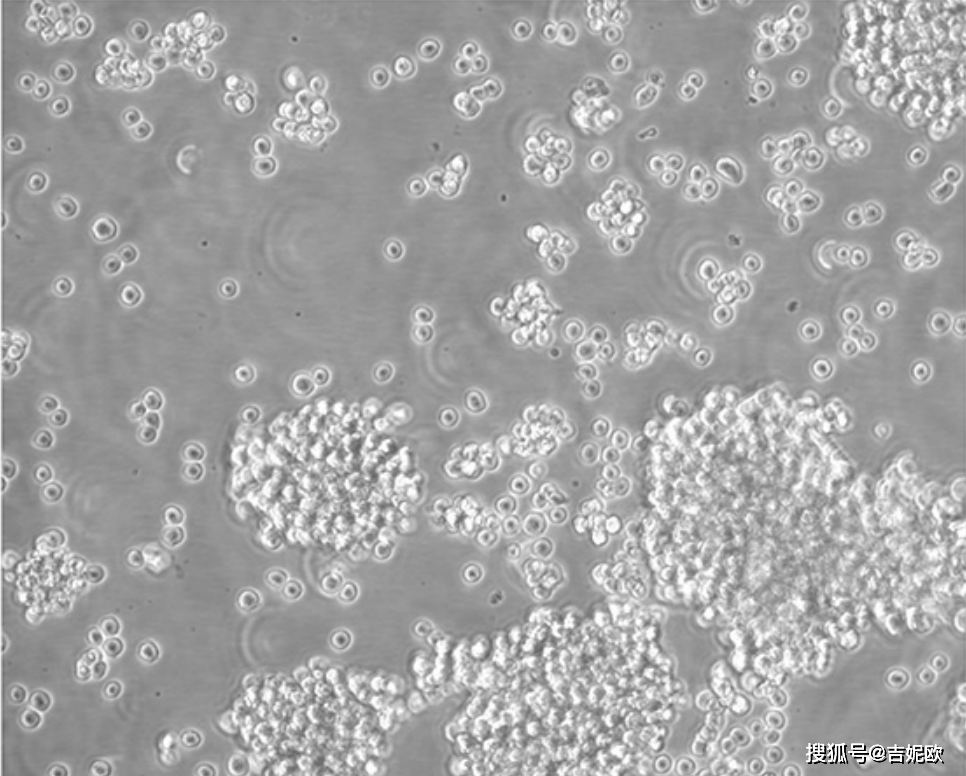 Raji细胞 P1-Raji细胞 Burkitt‘s人淋巴瘤细胞株_raji细胞侵染效率-CSDN博客