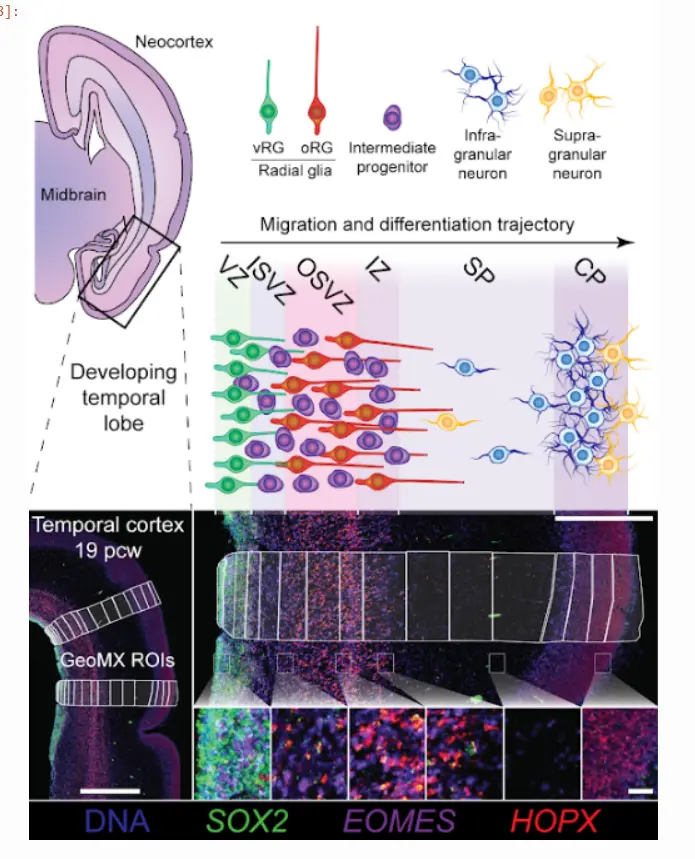 DSP(Digital Spatial Profiler)空间转录组与单细胞数据联合分析之cell2location-CSDN博客