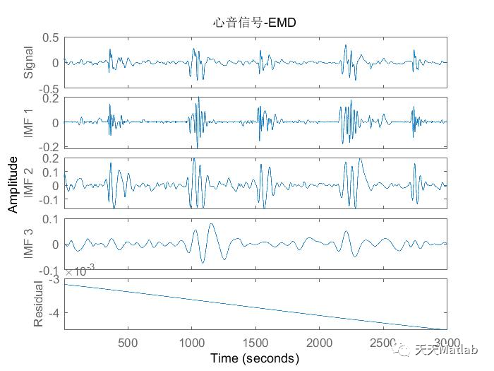 Matlab【特征提取】心音信号特征提取matlab系统matlab信号特征提取 Csdn博客