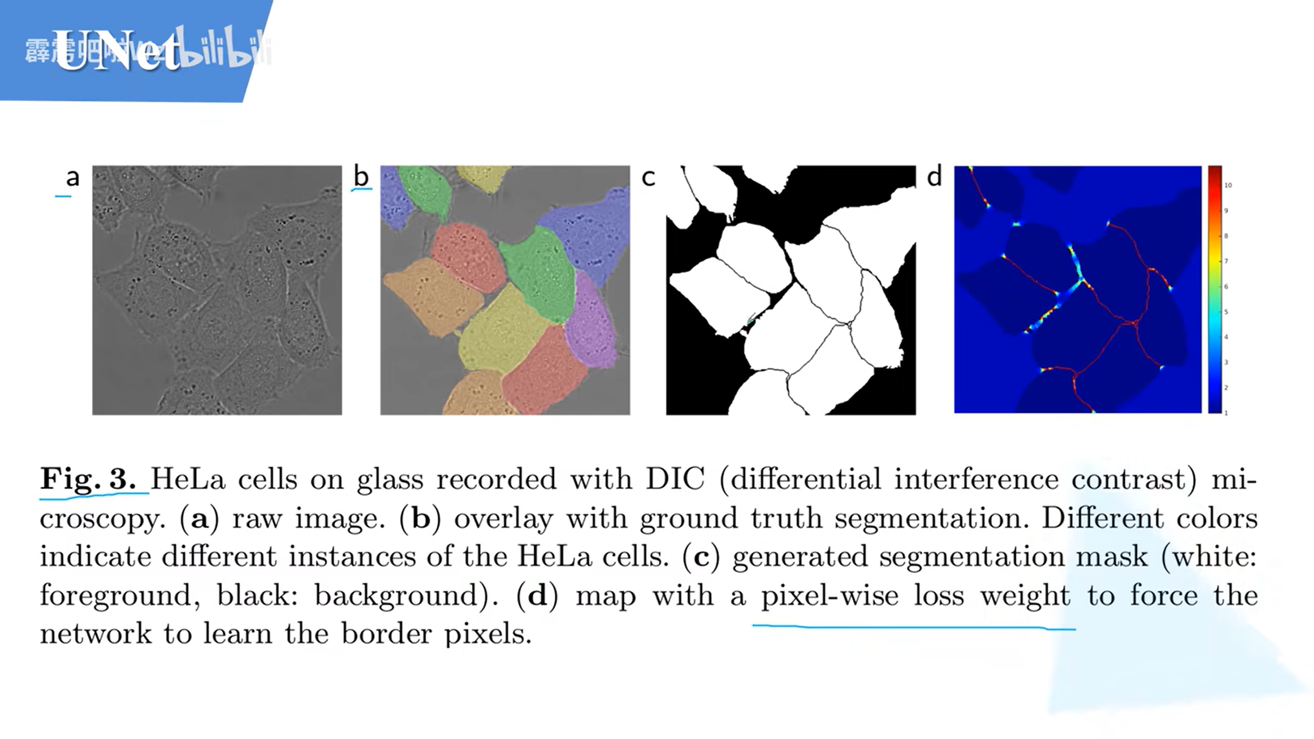 U-net_different blocks of unet feature maps指什么-CSDN博客