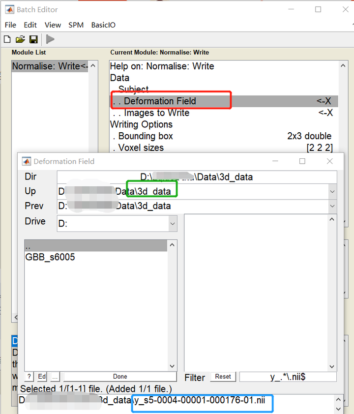 SPM数据预处理【“傻瓜”操作版】-CSDN博客