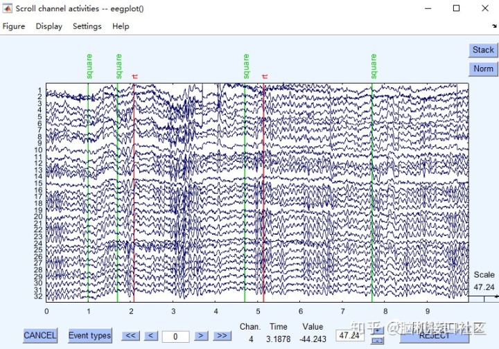 eeg数据集_eeglab教程系列(1)-加载、显示数据-CSDN博客