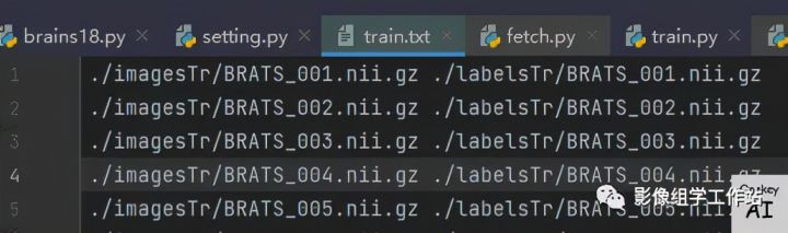 影像组学学员成果分享：BraTS2017数据集的迁移学习+深度学习提取特征+机器学习_影像组学深度学习复现_影像组学工作站的博客-CSDN博客