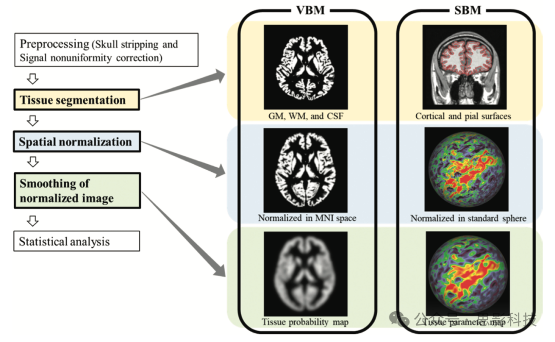 使用VBM和SBM在皮质形态分析中的优势_表面形态学测量技术sbm用t1wi图像可以吗-CSDN博客