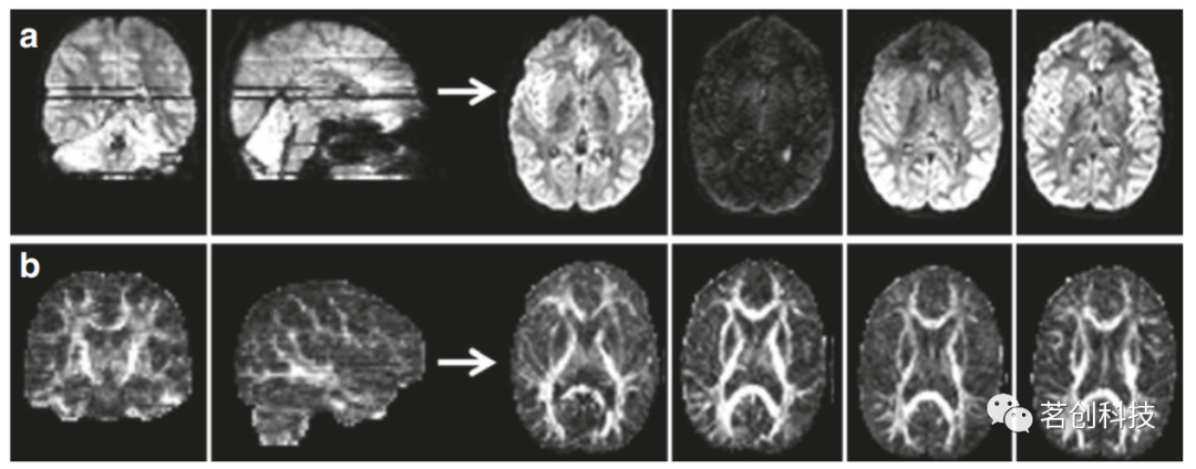BOLD fMRI和DTI：伪影、技巧和诀窍_fmri图像处理后有残影怎么办-CSDN博客