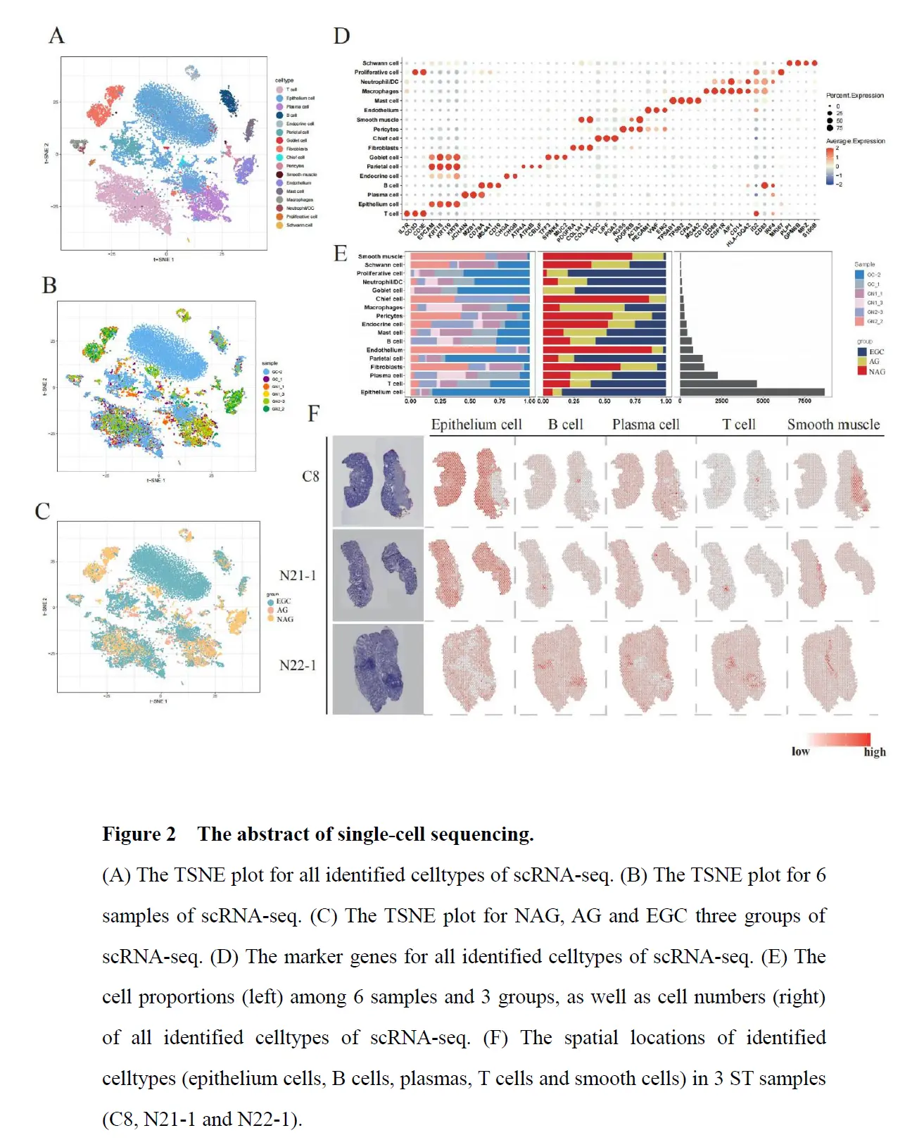 10X单细胞空间全面剖析早期胃癌进展中的免疫微环境_lgals9 免疫抑制-CSDN博客