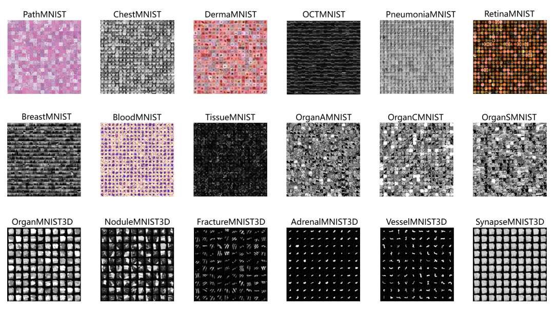 MedMNIST：18个数据集开启2D+3D医学影像之旅，可免费下载-CSDN博客