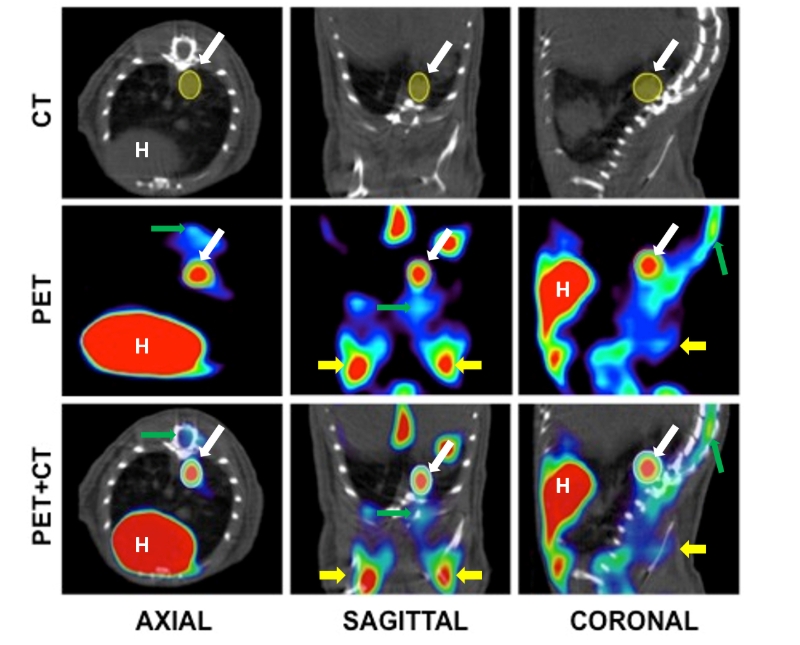 PET成像技术服务-CSDN博客