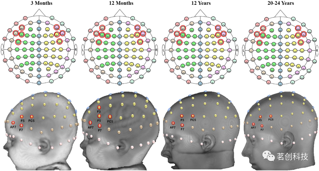 文献速递第1期：fNIRS 的近期研究_td-fnirs-CSDN博客