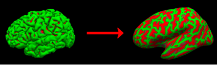 freesurfer全过程梳理-CSDN博客