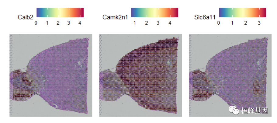 SCS【21】单细胞空间转录组可视化 (Seurat V5)-CSDN博客