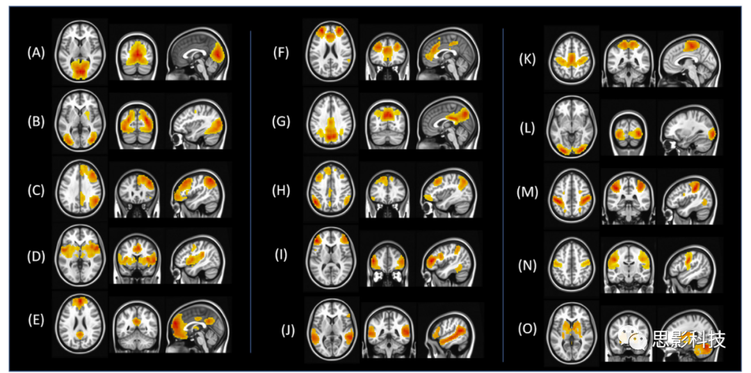 静息态fMRI的当前方法和新方向_rs-fmri具有四个维度-CSDN博客
