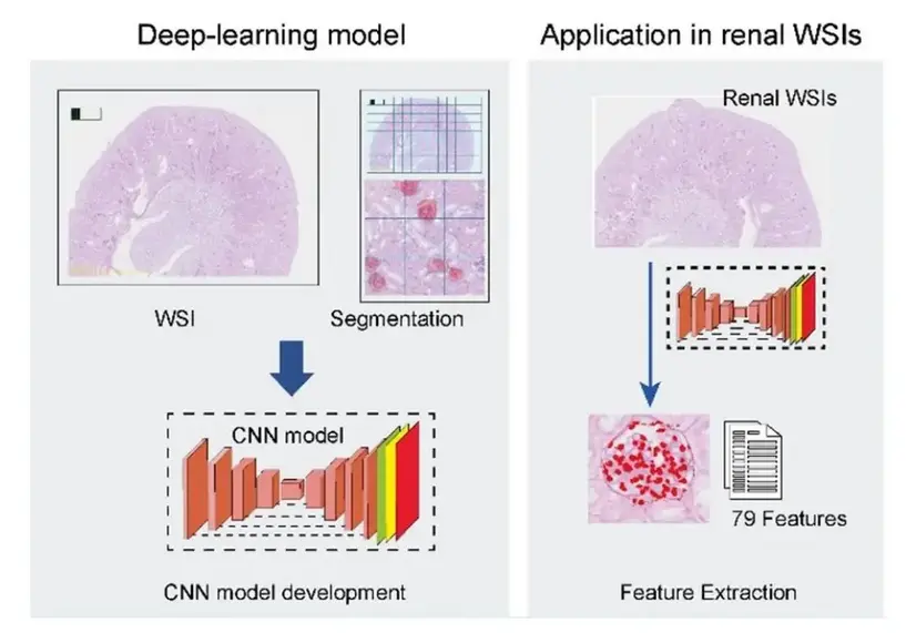 ISS空间转录组的细胞分割算法汇总(stardist、cellpose、QuPath、SCS)_python qupath-CSDN博客