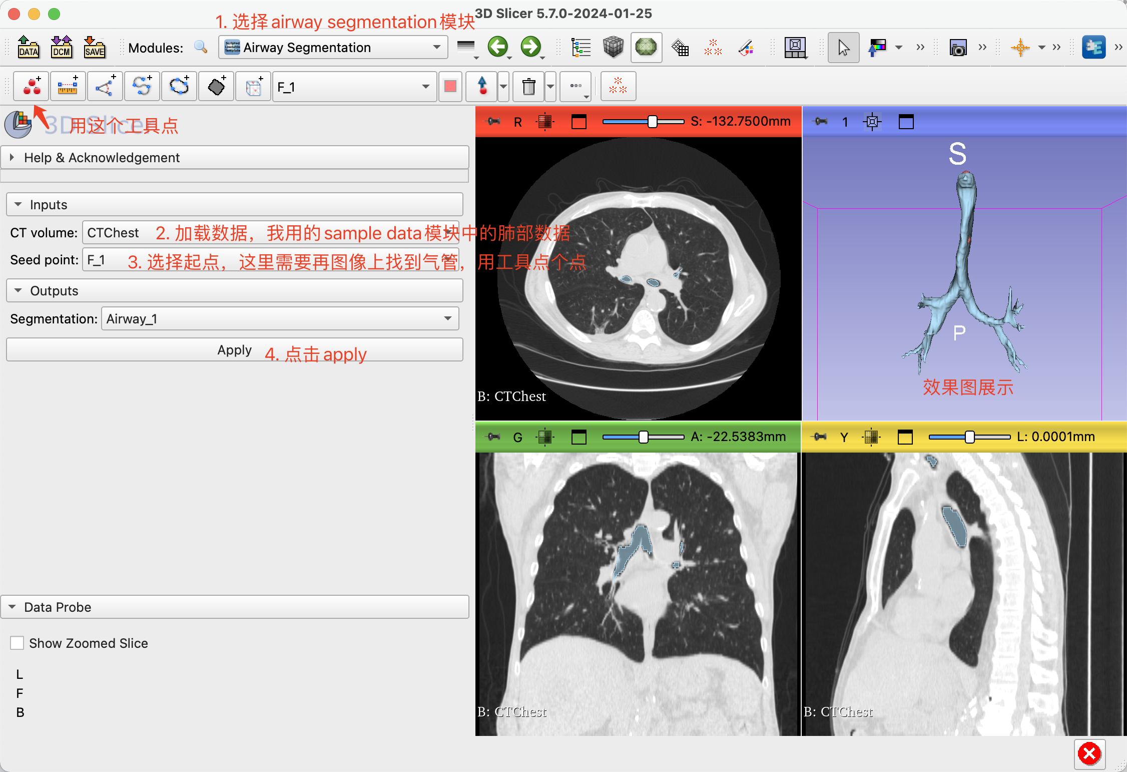 快准狠！在3D Slicer中，使用TotalSegmentator扩展可在1分钟内自动分割全身117个器官_totalsegmentator ...