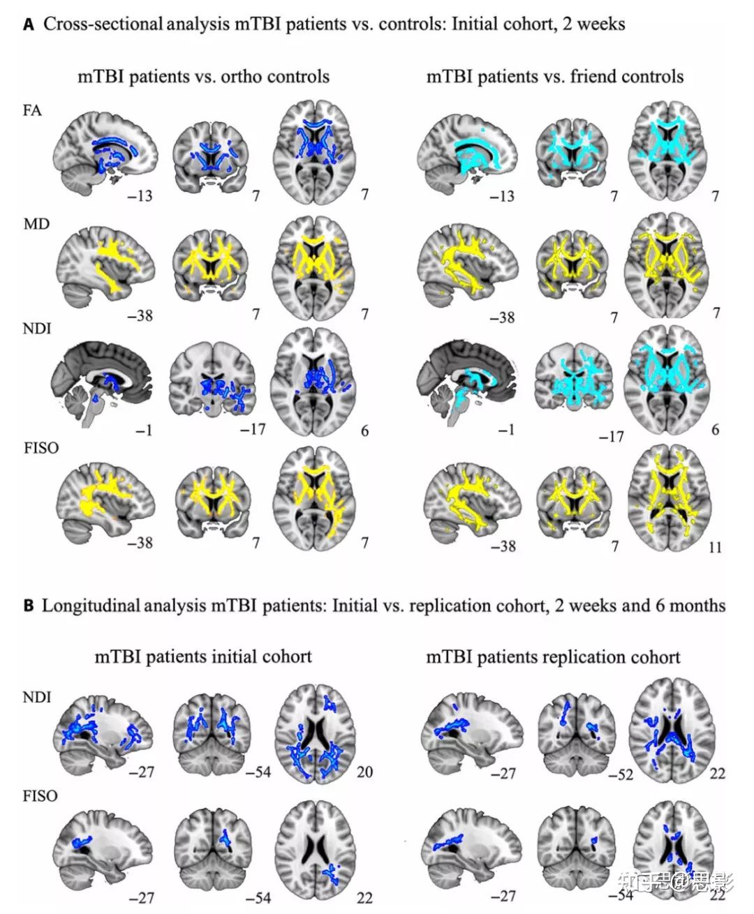 Science子刊：利用DTI和NODDI纵向研究揭示轻度脑外伤后的白质微结构改变_dti noddi等优劣势-CSDN博客