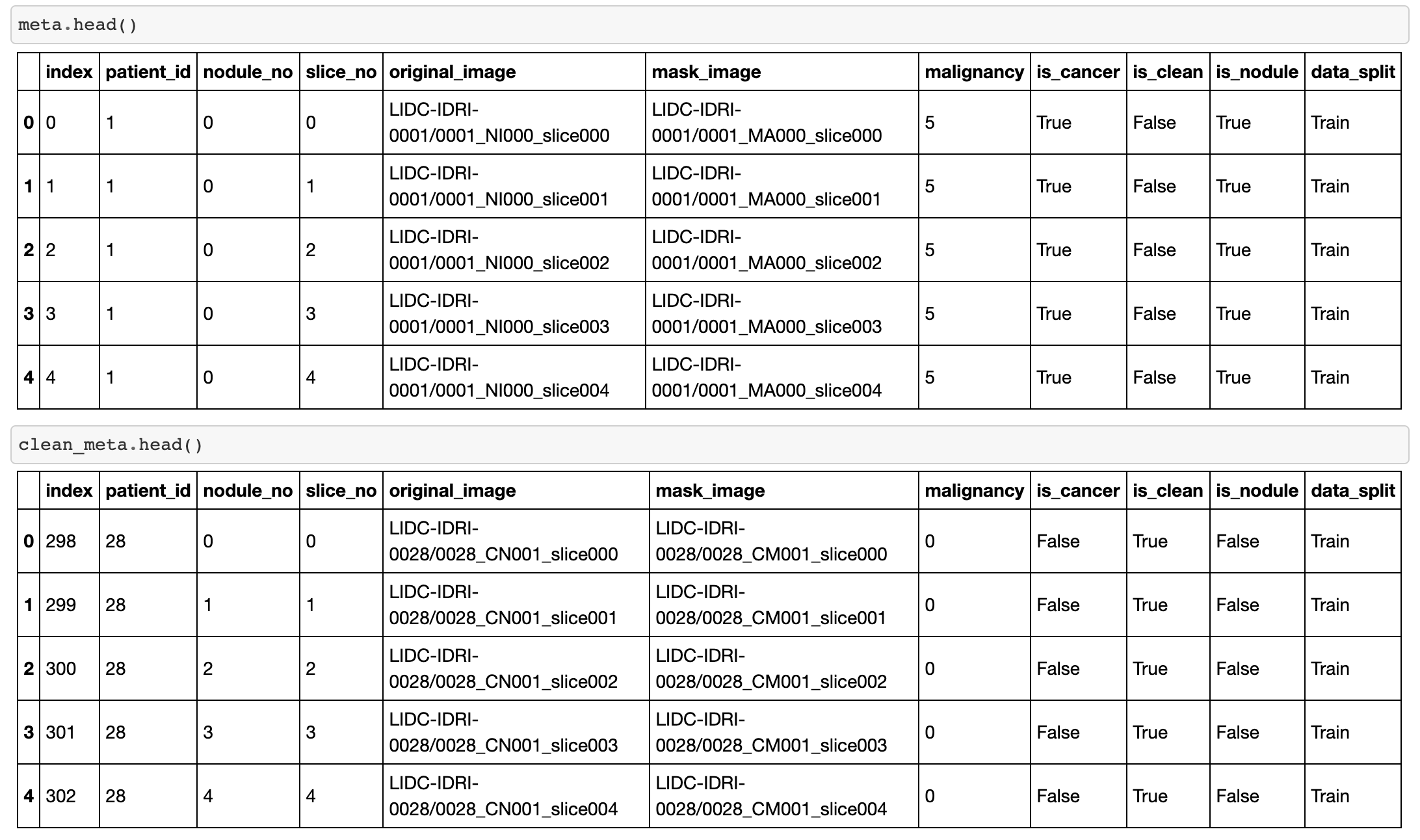 LIDC-IDRI肺结节数据集分割策略-CSDN博客