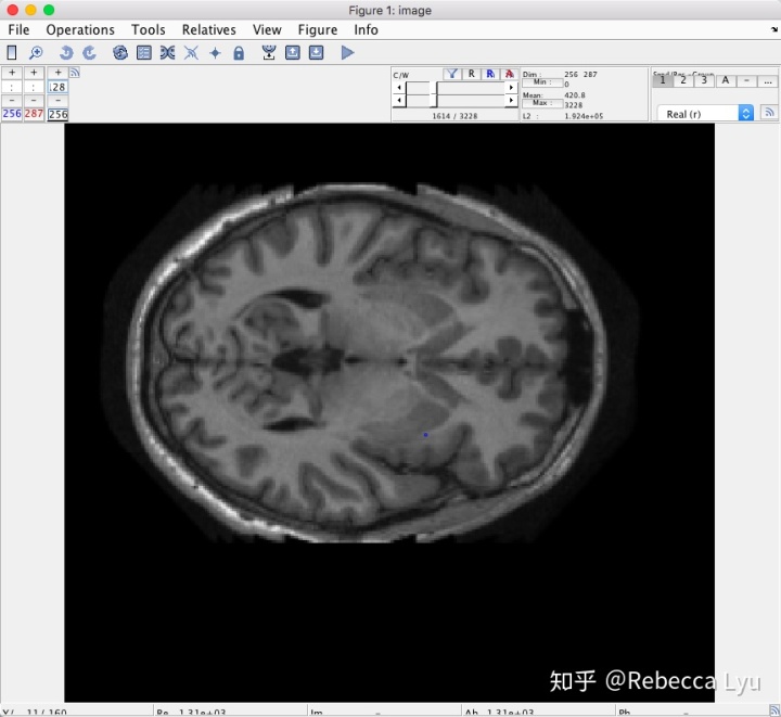 matlab保存nii_matlab读入及保存nii.gz格式的文件_weixin_39620535的博客-CSDN博客