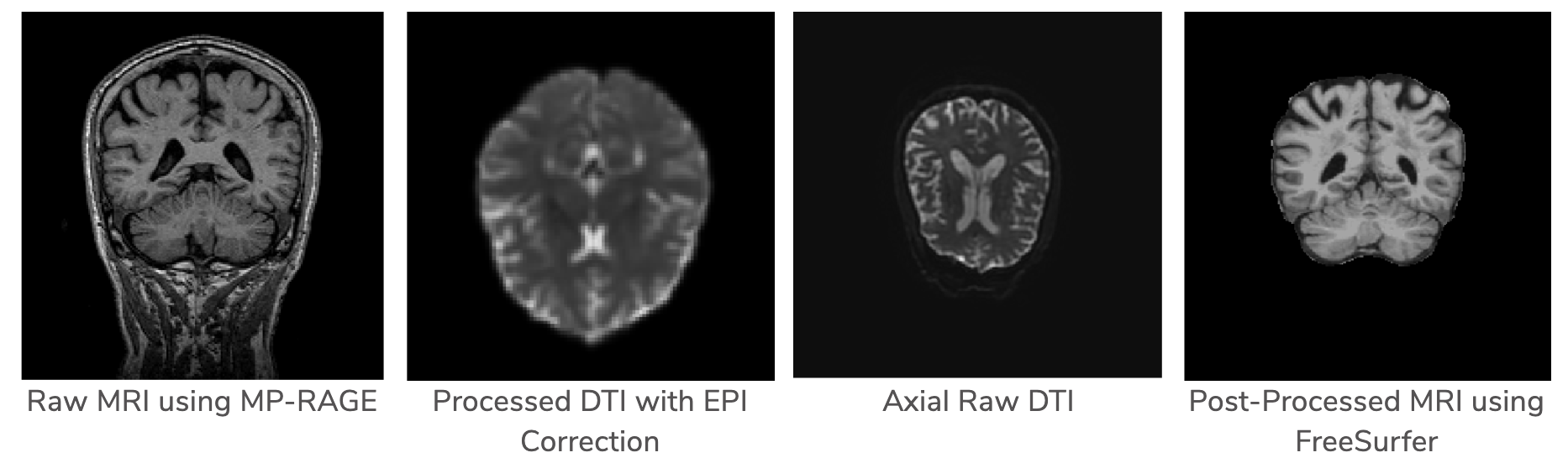 ADNI-MRI-PET_adni数据库有哪些数据-CSDN博客