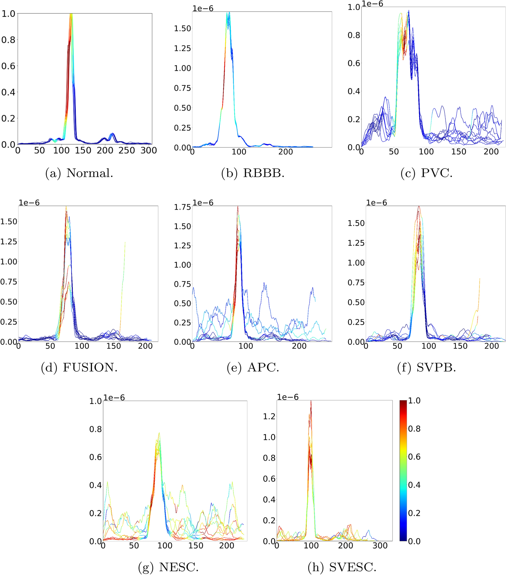 使用类激活热力图CAM对ECG信号分类进行可视化_热力图 心电-CSDN博客