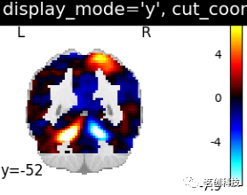 Nilearn：绘制大脑图像-CSDN博客