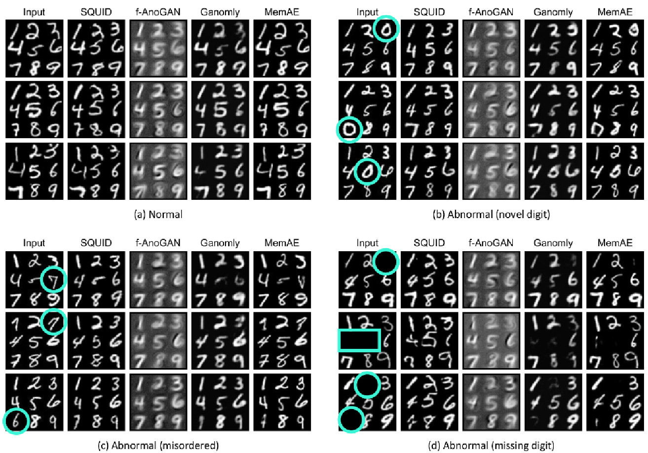 最新异常检测方法SQUID，基于深度特征In-painting_in-paintng 深度学习-CSDN博客