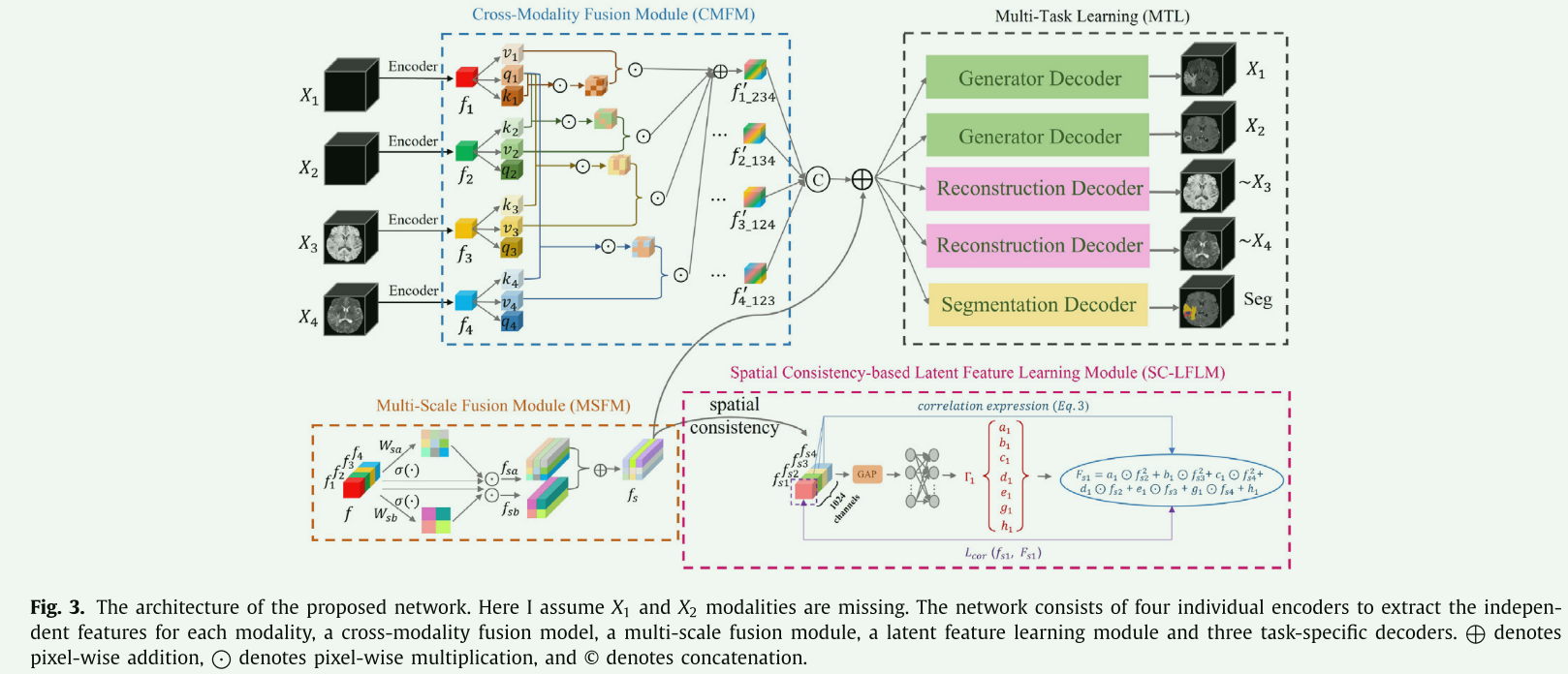 [论文阅读笔记]Feature fusion and latent feature learning guided brain tumor segmentation and missing ...