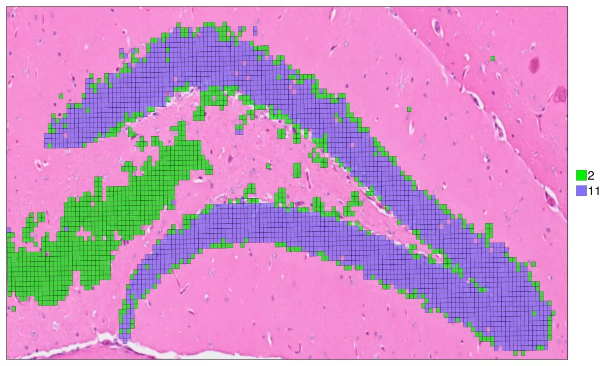 10X空间转录组Visium && HD && Xenium分析全更新_10x visium和hd的区别-CSDN博客