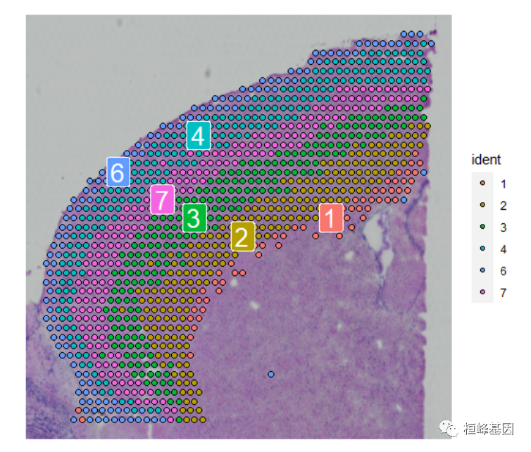 SCS【21】单细胞空间转录组可视化 (Seurat V5)-CSDN博客