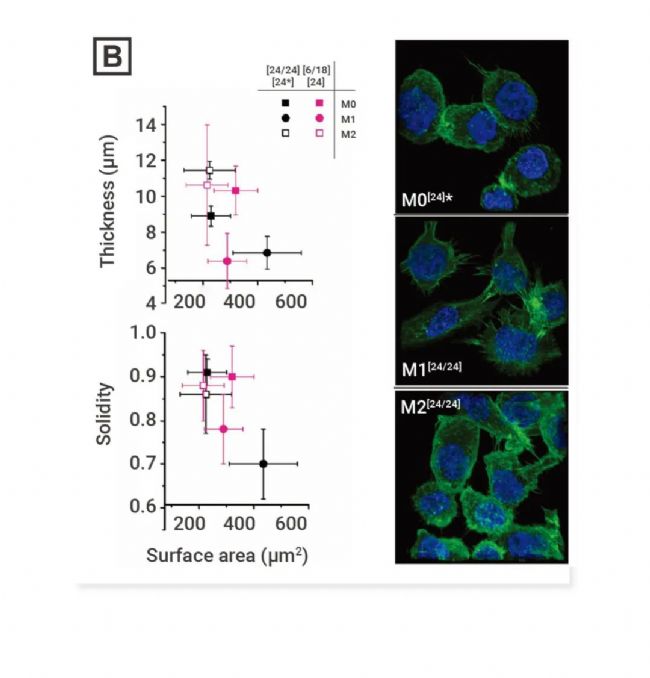 滴滴滴！巨噬细胞变形记：激活和分化指南 |MedChemExpress (MCE)_巨噬细胞 镜下 40倍-CSDN博客