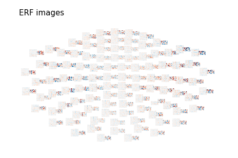 脑电分析系列[MNE-Python-15]| Epochs数据可视化-CSDN博客