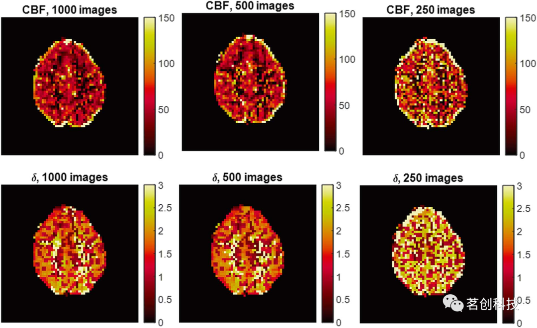 J Magn Reson Imaging：磁共振指纹(MRF)动脉自旋标记(ASL)的灌注特性估计-CSDN博客