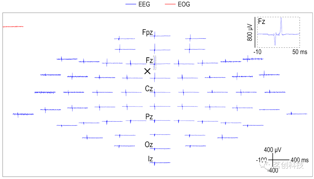 rt-TEP工具：实时显示TMS诱发电位，最大化皮层激活和最小化伪影_肌电诱发 tep-CSDN博客