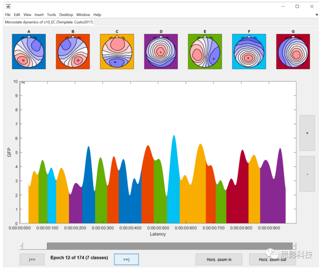MICROSTATELAB：用于静息状态微状态分析的EEGLAB工具箱_matlab脑电静息态分析-CSDN博客
