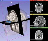 vtk c++ 图像分割_3D Slicer: 开源医学图像处理与可视化平台-CSDN博客