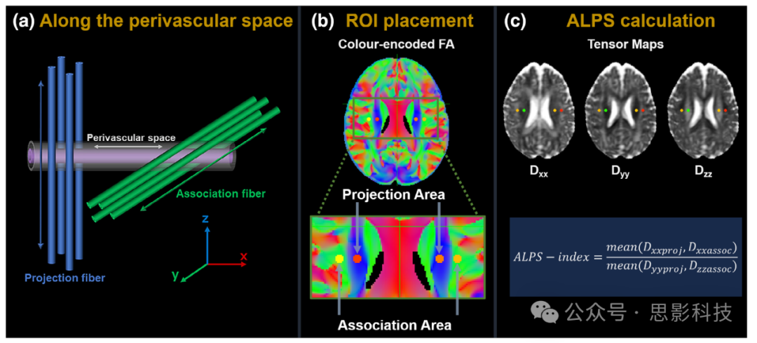磁共振成像评估脑淋巴系统活性_dti alps-CSDN博客