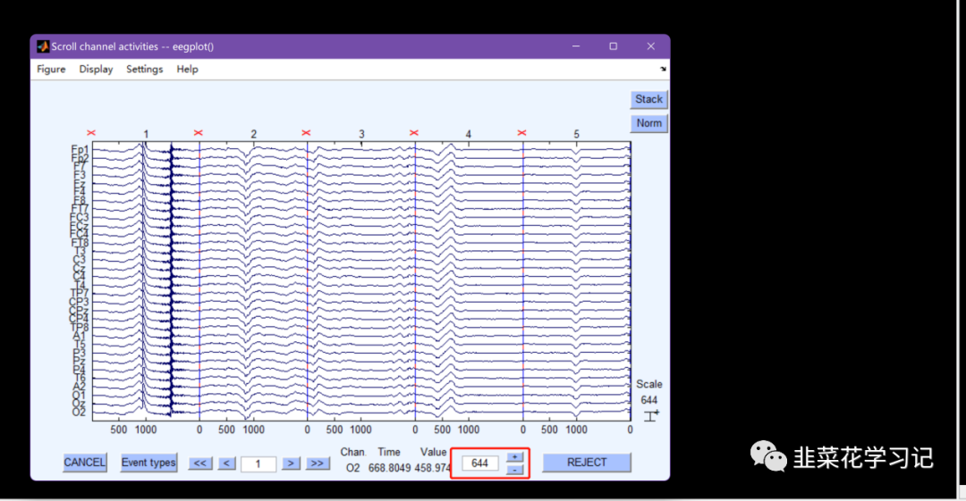 如何使用eeglab画出理想的脑电图_eeg导联热图画法-CSDN博客