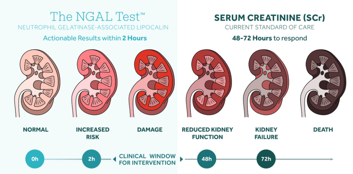 丹麦Bioporto NGAL Test™检测试剂盒-CSDN博客