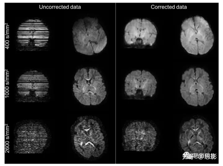 发展人脑连接组计划中（dHCP)婴儿扩散 MRI 的自动化处理流程_人类连接组计划 csdn-CSDN博客