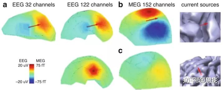 电生理绘图和源成像_meg信号-CSDN博客