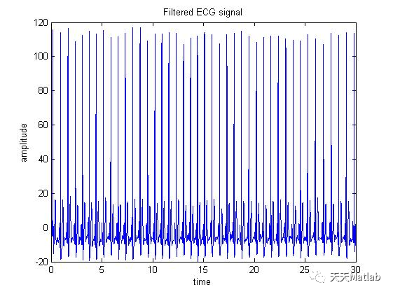 【心电信号】心电图峰值检测附Matlab代码_ecg信号找峰值_Matlab科研工作室的博客-CSDN博客