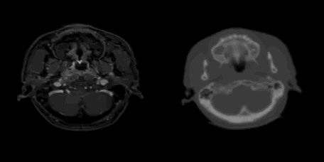 基于强化学习的图像配准 - Image Registration: Reinforcement Learning Approaches_非刚性 ...