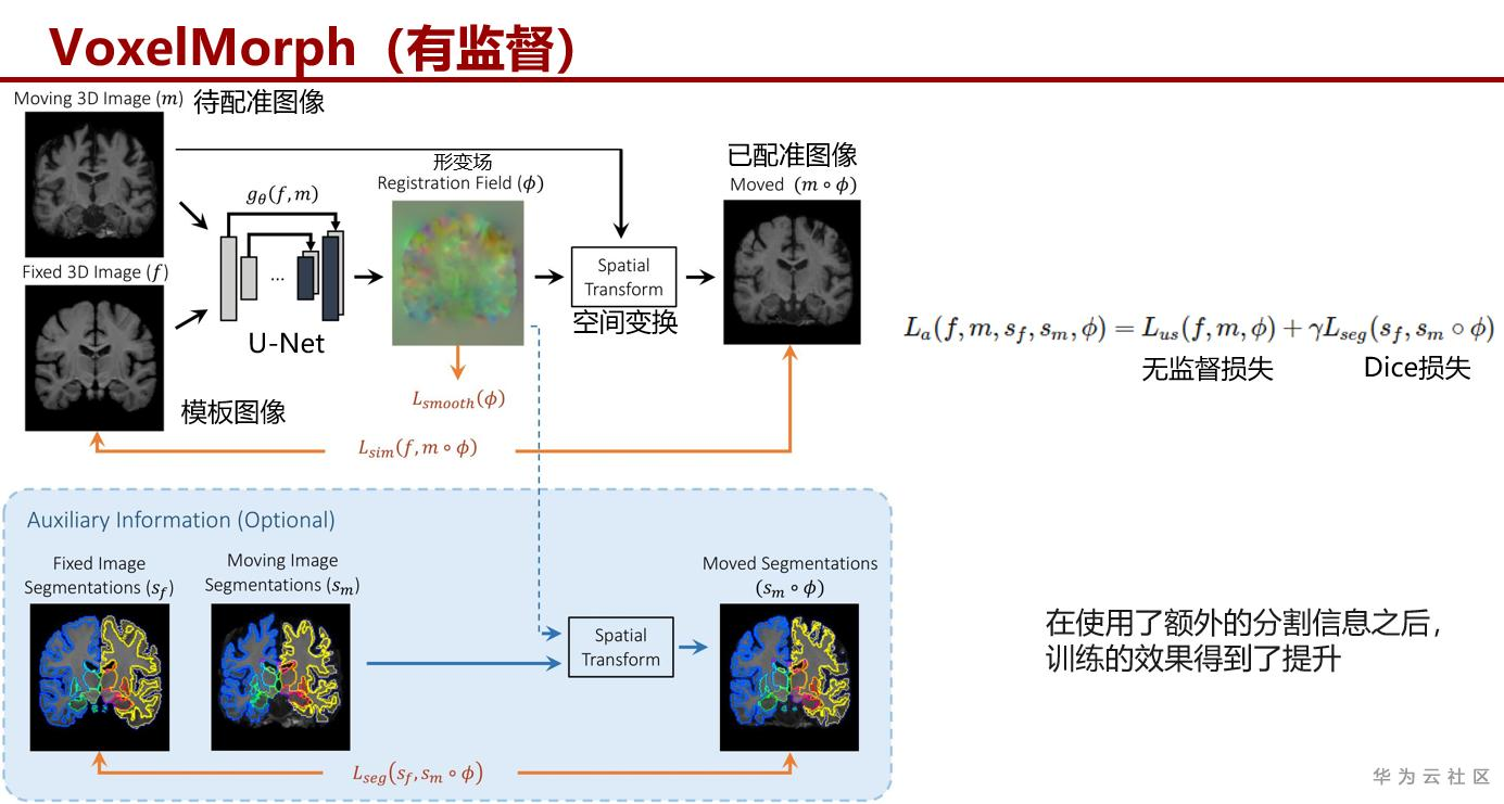 医学图像配准概览和深度学习图像配准前沿热点论文VoxelMorph_柔性配准-CSDN博客