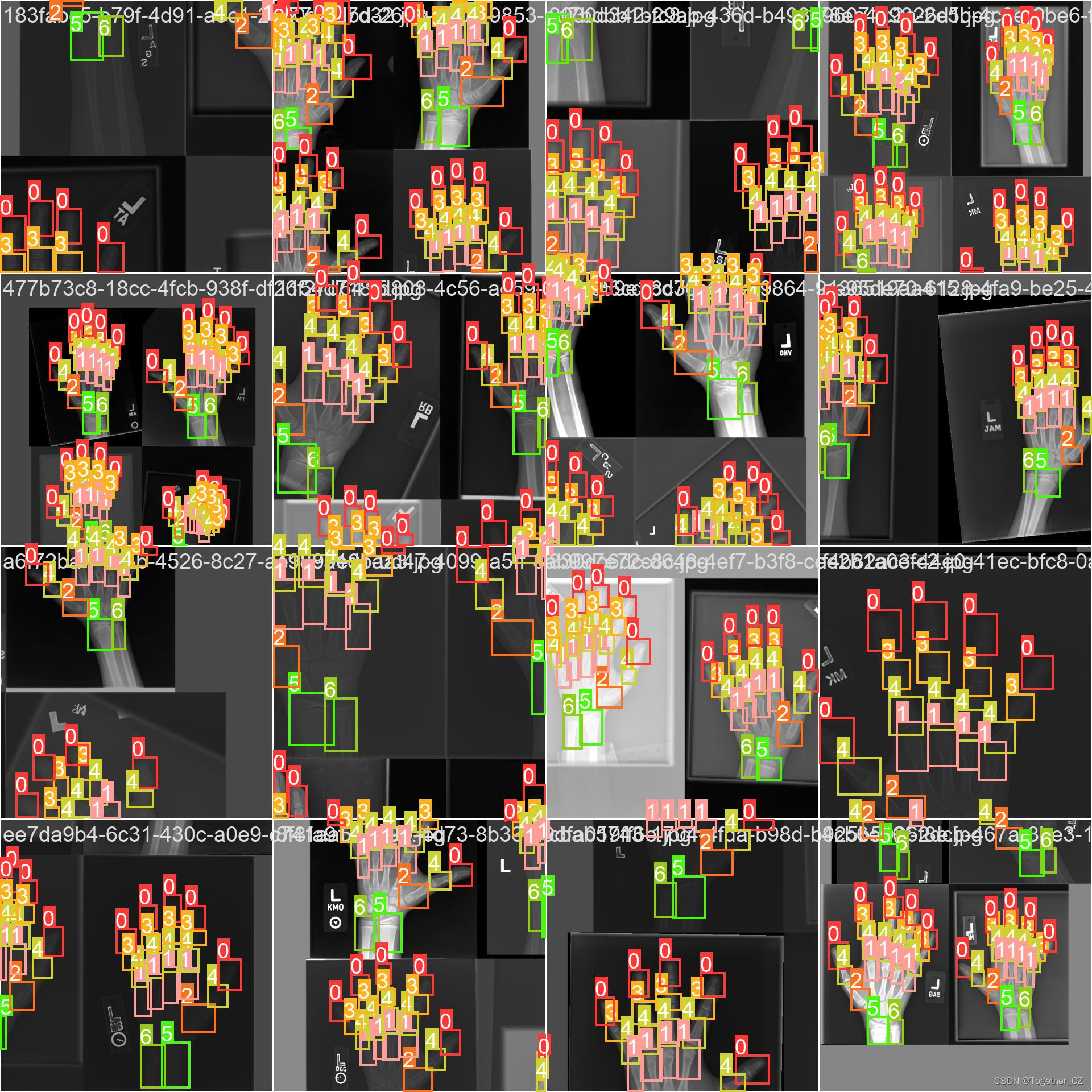 基于YOLOv5开发构建手部X光骨骼检测识别分析系统_yolov5骨龄检测-CSDN博客