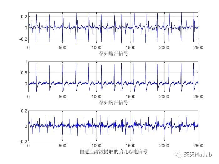 心电信号ecg基于nlms算法实现孕妇胎儿心电信号提取附matlab代码 论文程序 新手专用母体心电提取胎儿 Csdn博客 