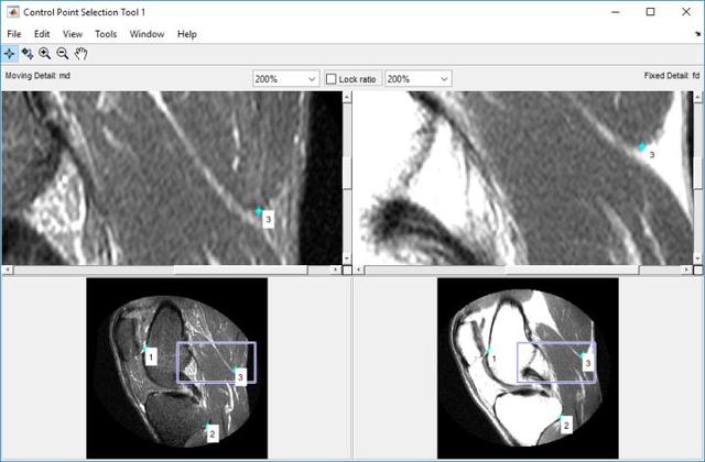 matlab 图像显著性检测ft_MATLAB图像配准各方法介绍和对比-CSDN博客