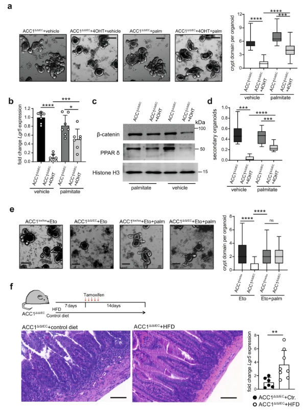 AbMole|乙酰辅酶 A 羧化酶 1 介导的新脂肪合成对肠道干细胞功能的影响_acc1和fas-CSDN博客