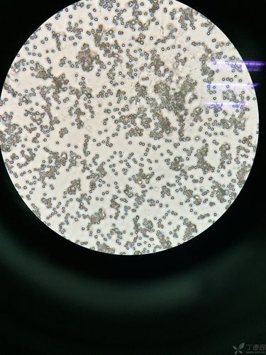 火爆Raw264.7细胞形态学、生长速率、条件揭秘_raw细胞有几种分化模式-CSDN博客